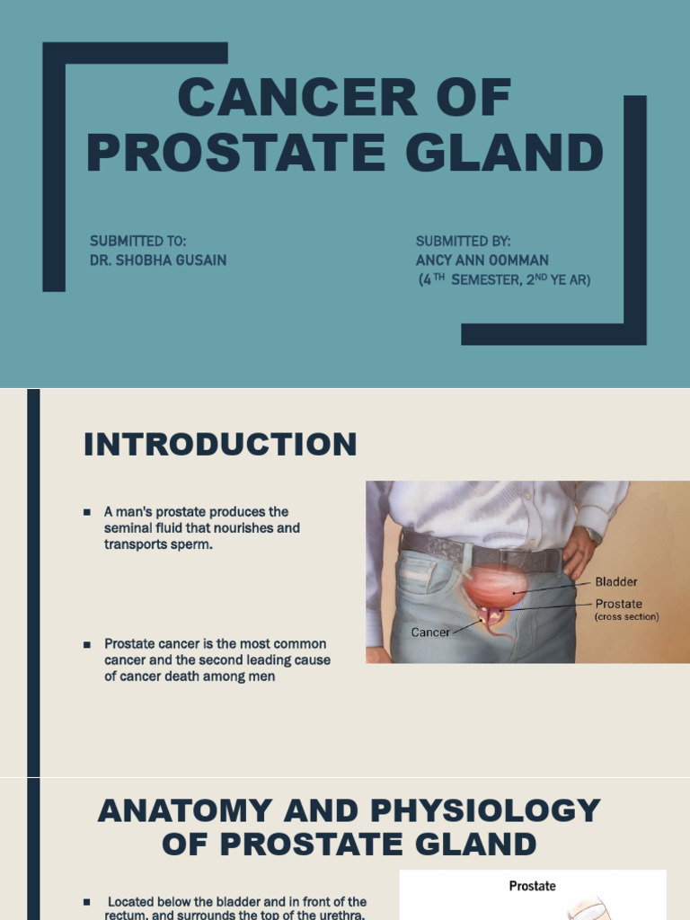 Cancer of Prostate Gland. | PDF | Prostate | Prostate Cancer