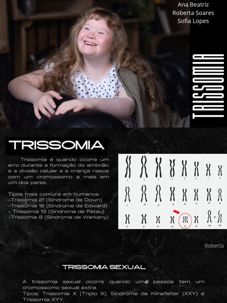 Trissomia 21 | PDF | Síndrome de Down | Causas de morte