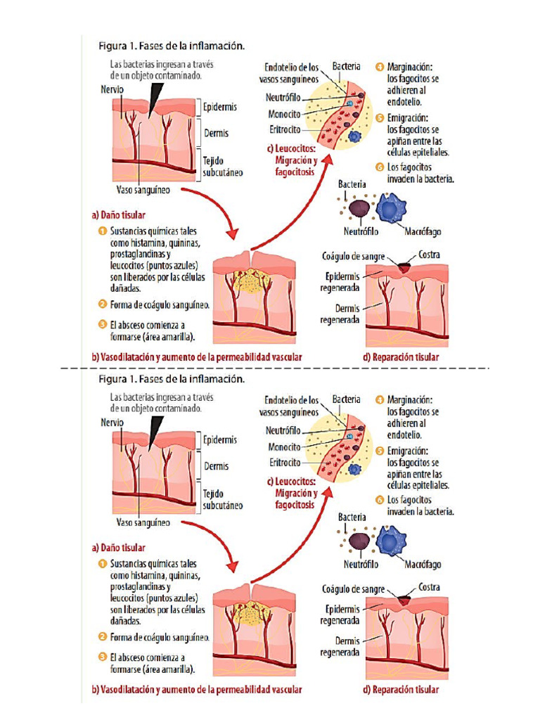 FASES DE LA INFLAMACION SISTEMA INMUNE | PDF