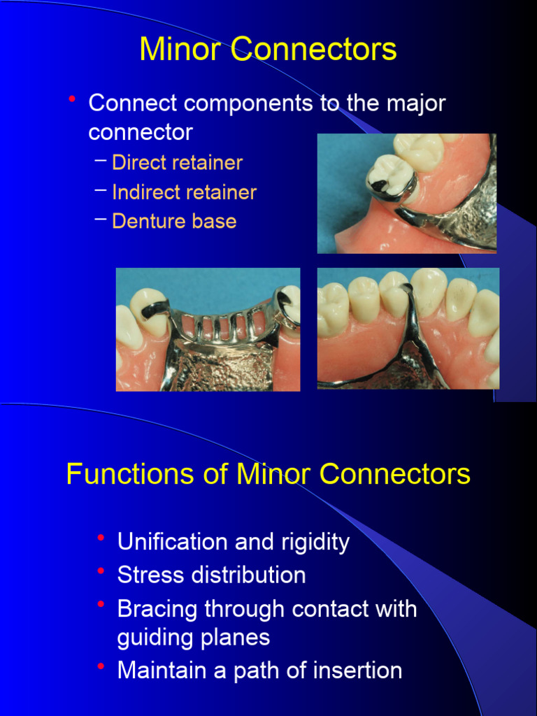 Minor Connectors-1 | PDF | Tooth | Mouth