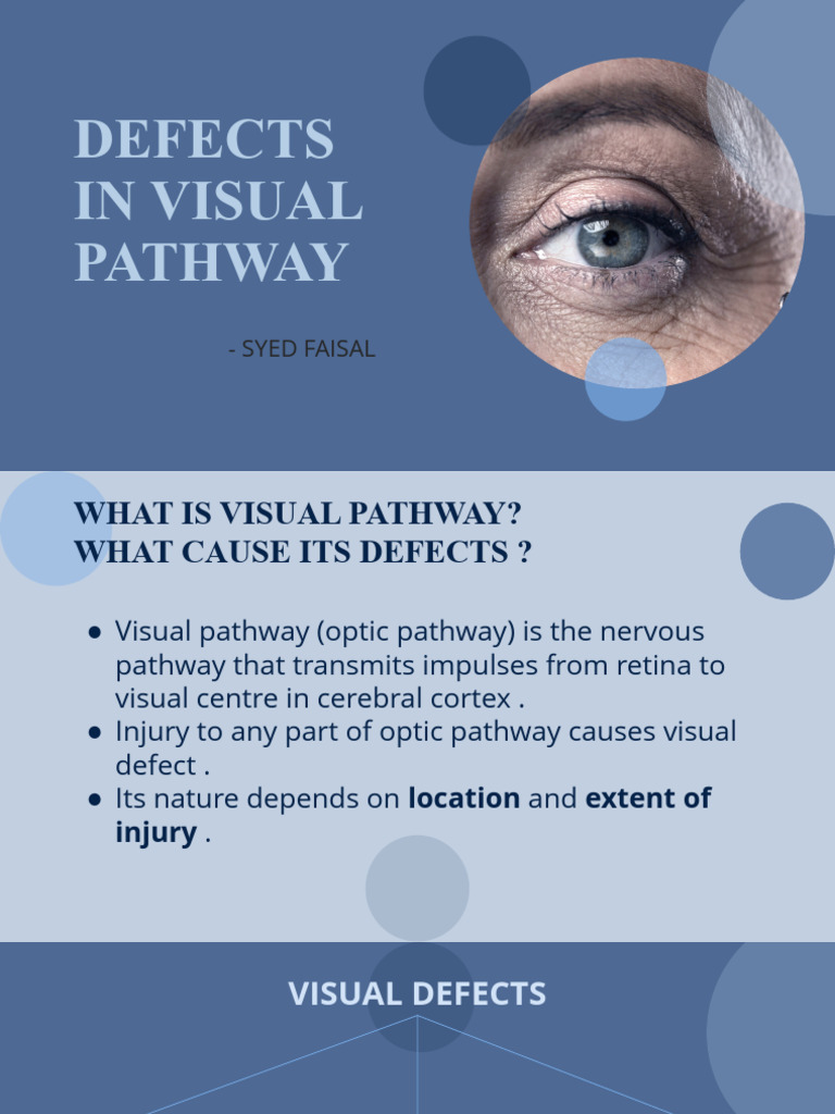 Defects in Visual Pathway | PDF | Visual System | Diseases And Disorders