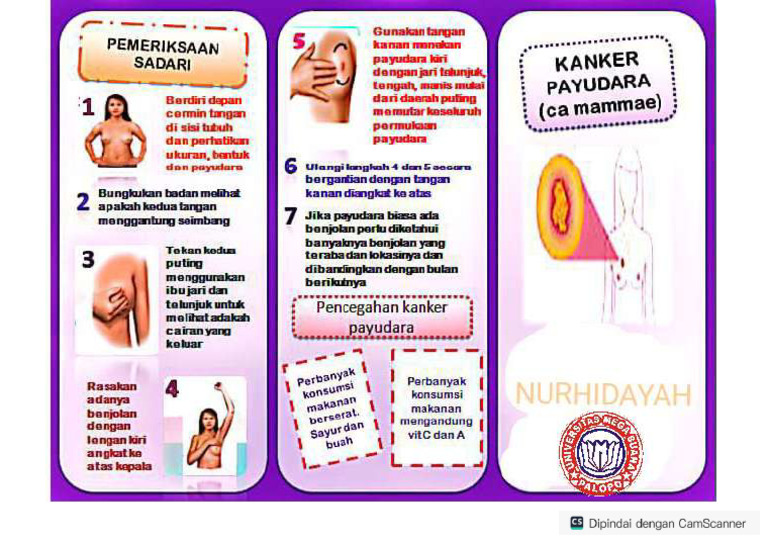 Leaflet Ca Mammae | PDF