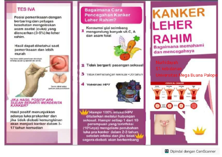 Leaflet Ca Serviks | PDF
