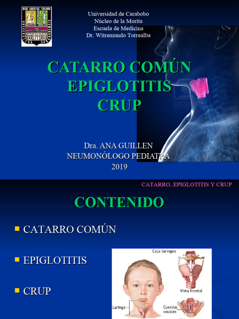 Catarro, Crup y Epiglotitis | PDF | Resfriado comun | Medicina