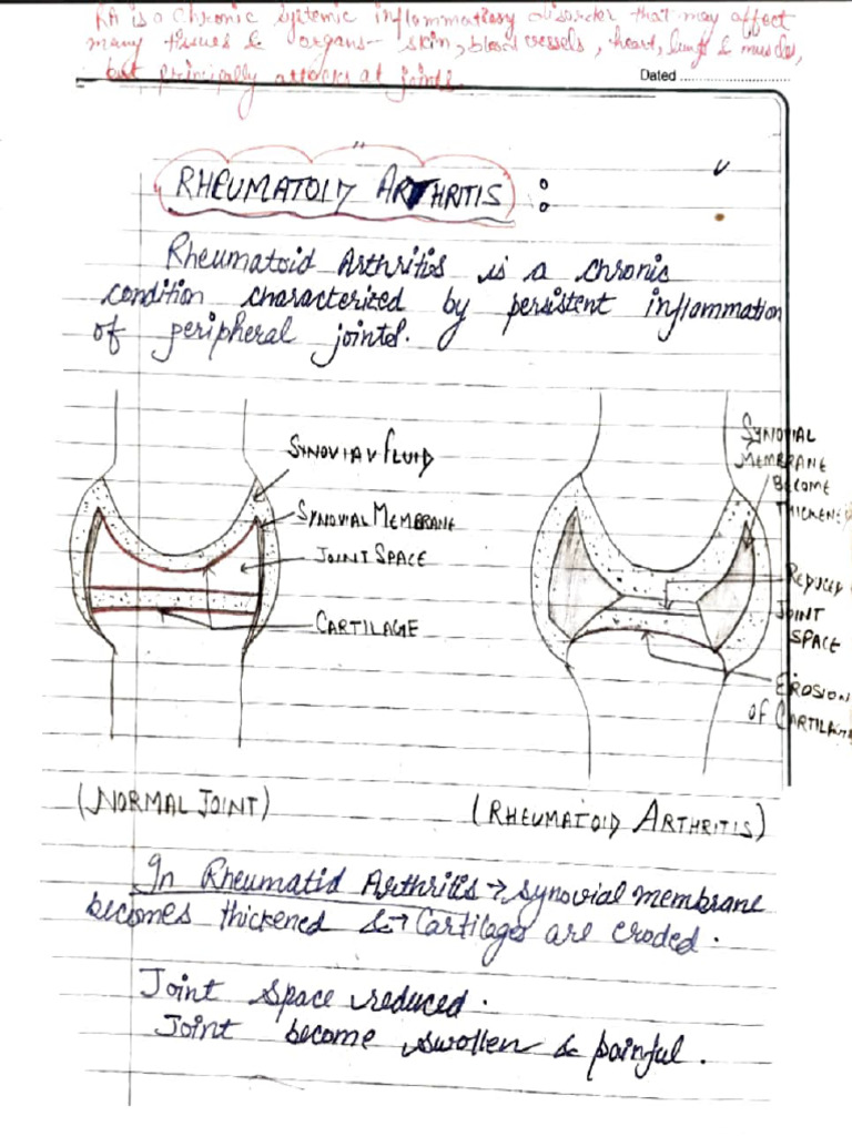 Rheumatoid Arthritis Pdf Arthritis Aging Associated Diseases