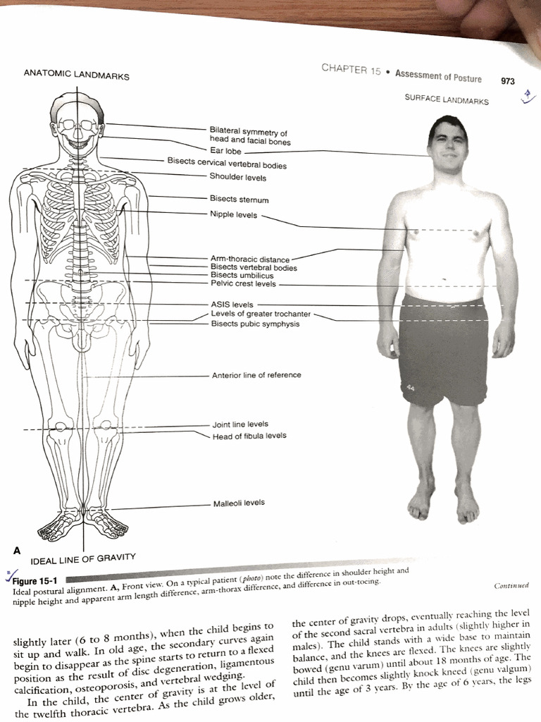 Posture Assessment Magee | PDF
