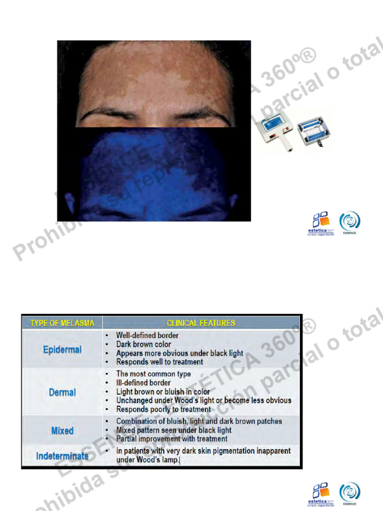 Apuntes MELANOGENESIS PIGMENTACION DISCROMIAS Ok | PDF | Sistema ...