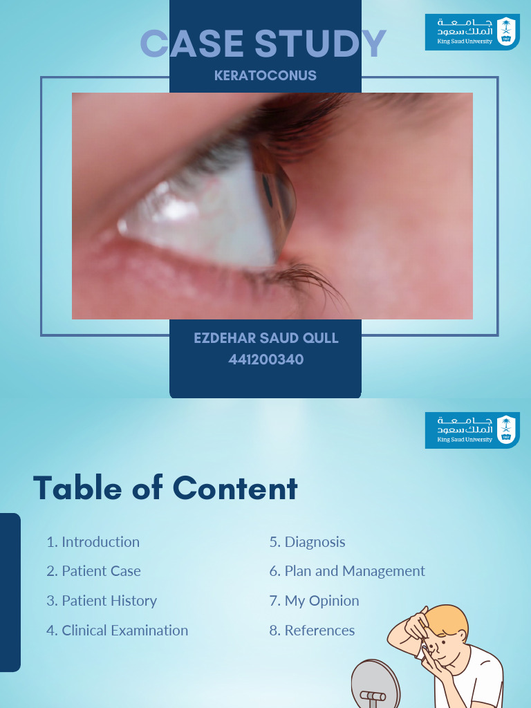Keratoconus Case - Ezdehar Qull | PDF