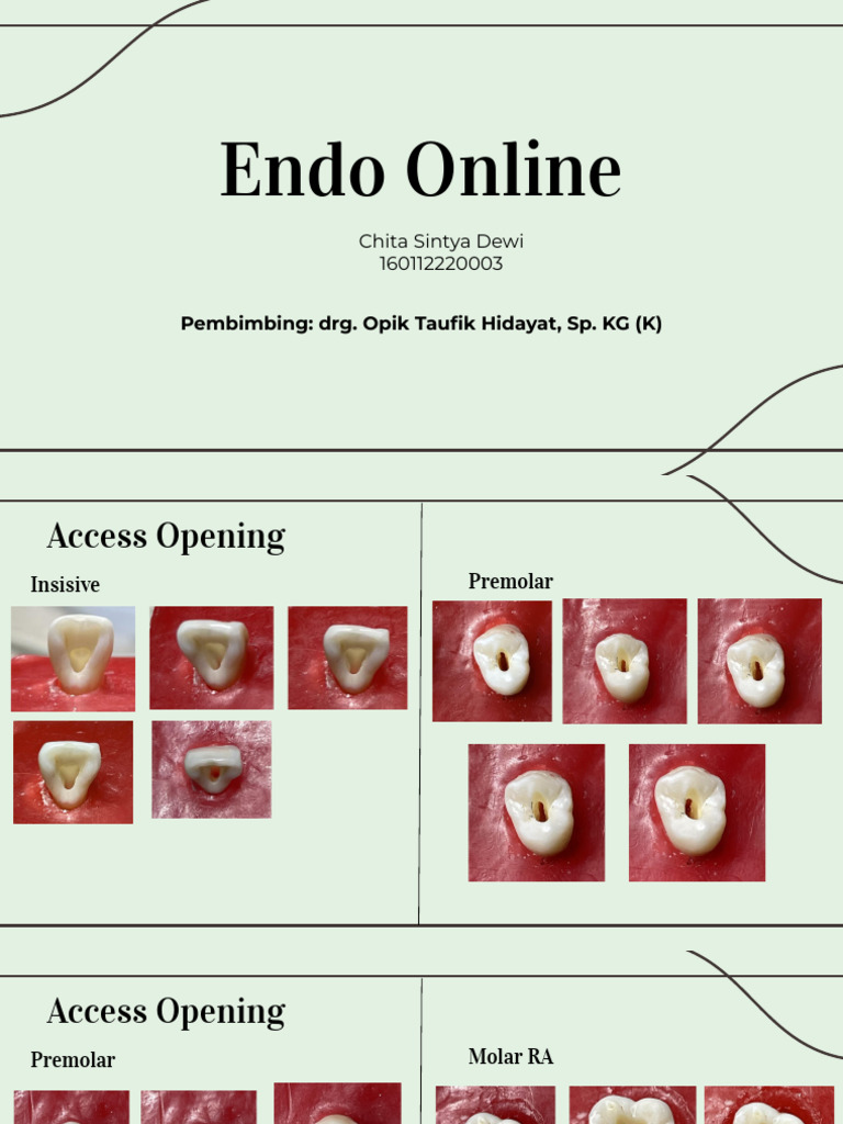 Endo Online | PDF | Dental Anatomy | Tooth