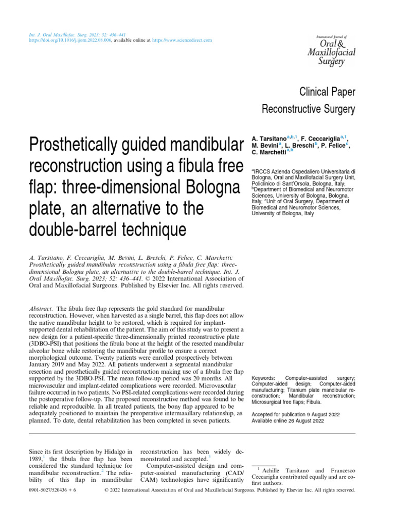 Prosthetically Guided Mandibular Reconstruction Using Fibula Free Flap ...