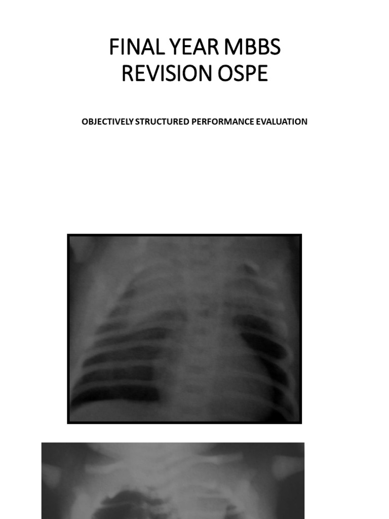 Paeds Ospe | PDF | Self-Improvement | Wellness