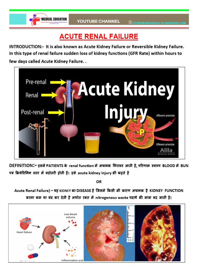 Acute Renal Failure | PDF