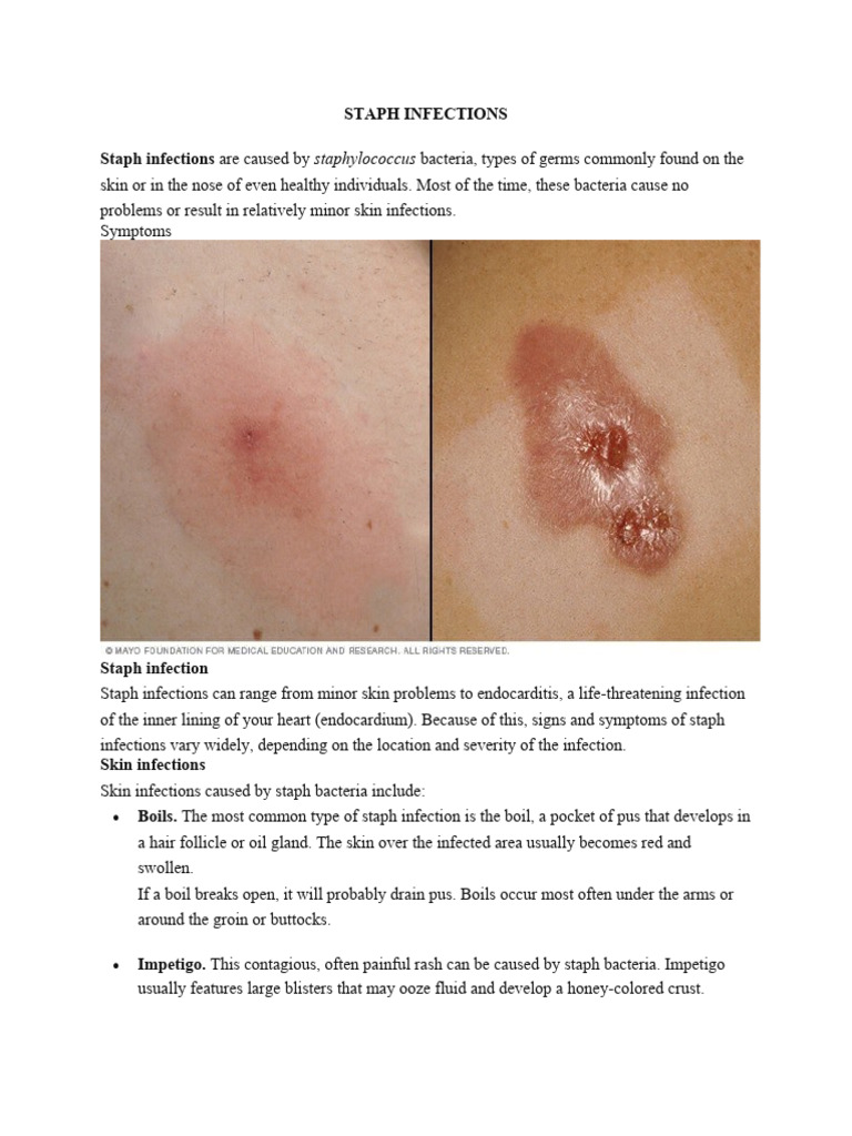 Lec 10 - Staph, Strep, E. Coli & Pseudomonas Infections | PDF ...