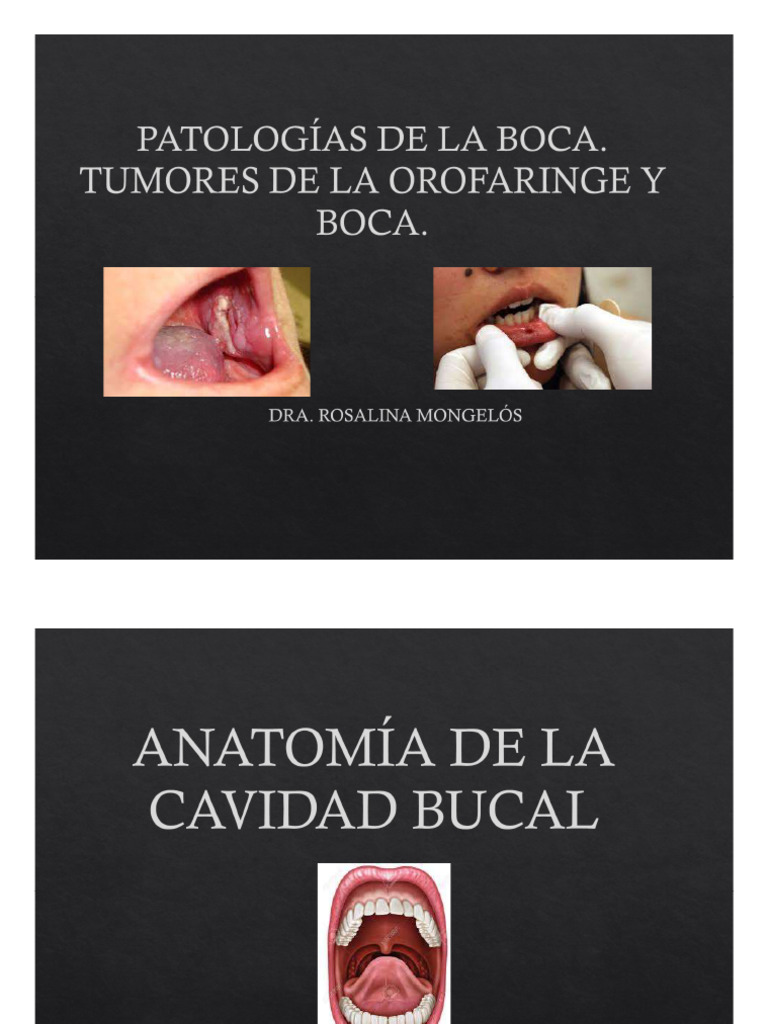 Clase. Patologã As de La Boca. Dra. Rosalina Mongelã S | PDF | Ciencia ...