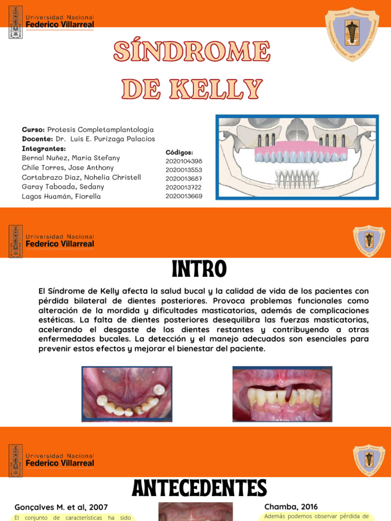 Síndrome de Kelly: Impacto y Tratamiento | PDF | Odontología | Boca