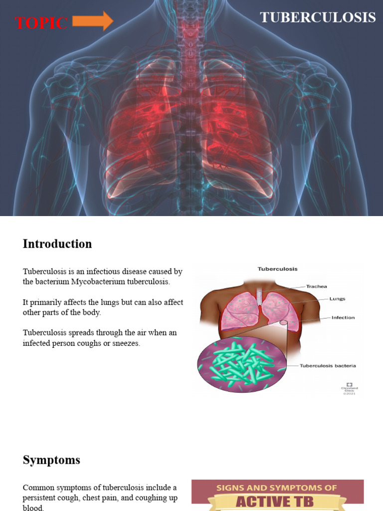 Tuberculosis Pdf Tuberculosis Animal Diseases
