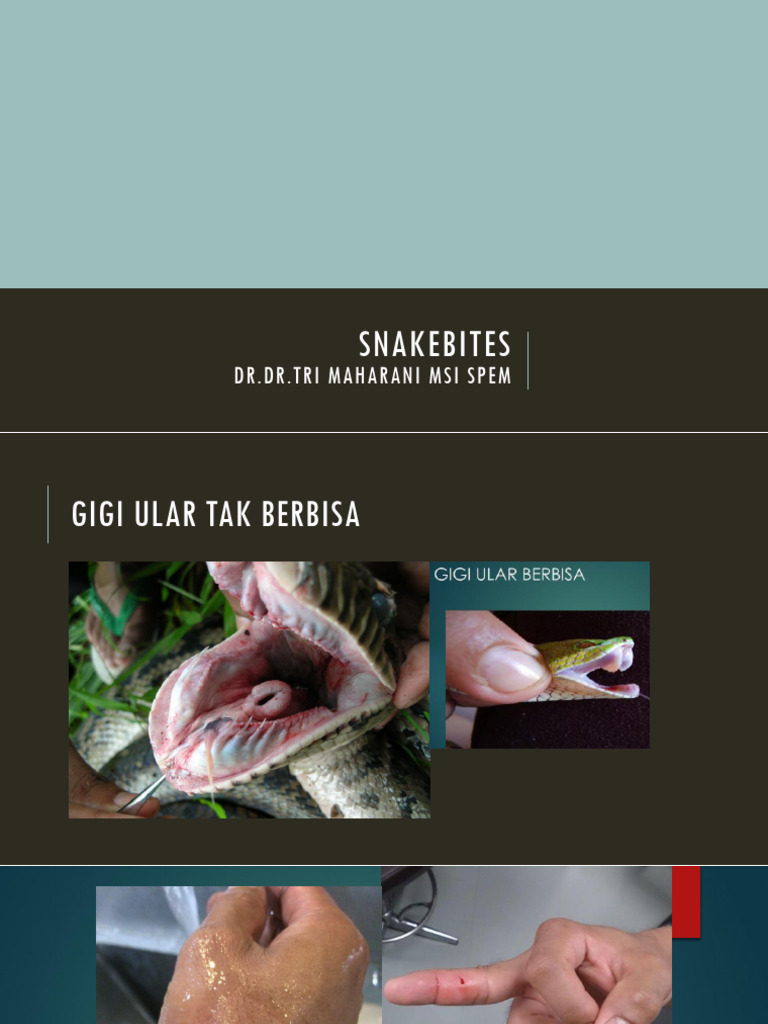 Snakebite Treatment and First Aid Guide | PDF | Clinical Medicine | Medical Specialties