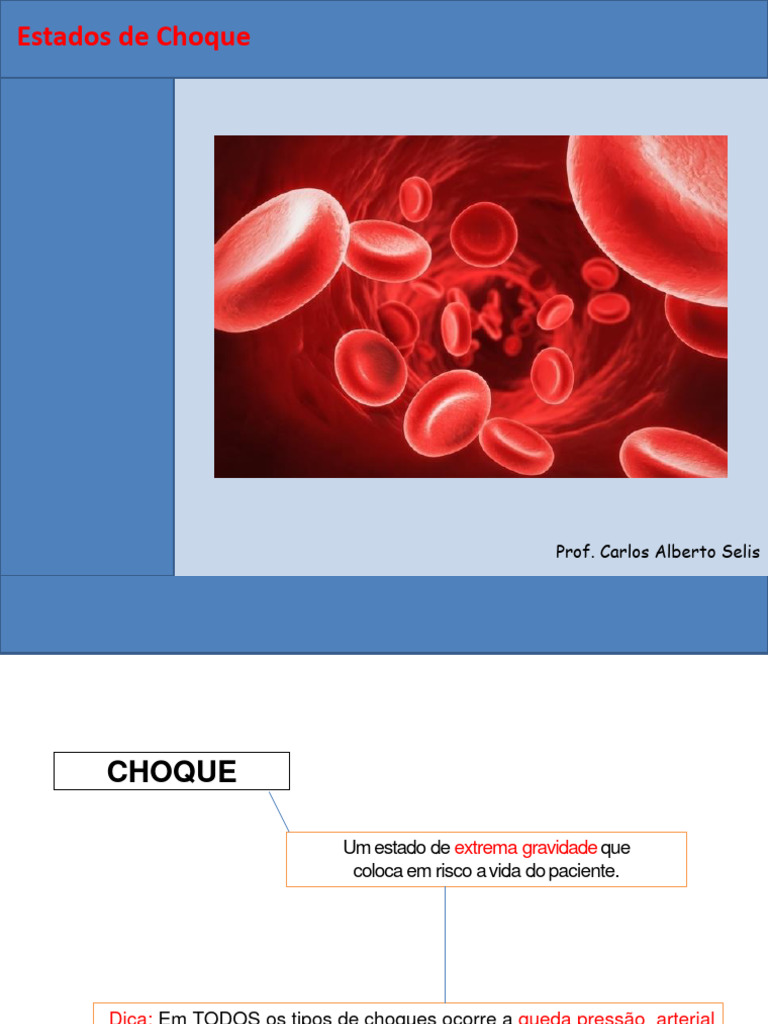 Tipos de Choques | PDF | Choque (circulatório) | Coração