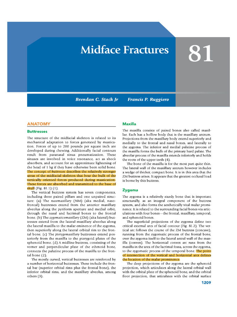 Midfacial Fracture:ZMC Fracture | PDF | Skeletal System | Human Head ...