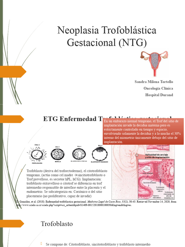 Neoplasia Trofoblástica Gestacional (NTG) : Sandra Milena Tortello ...