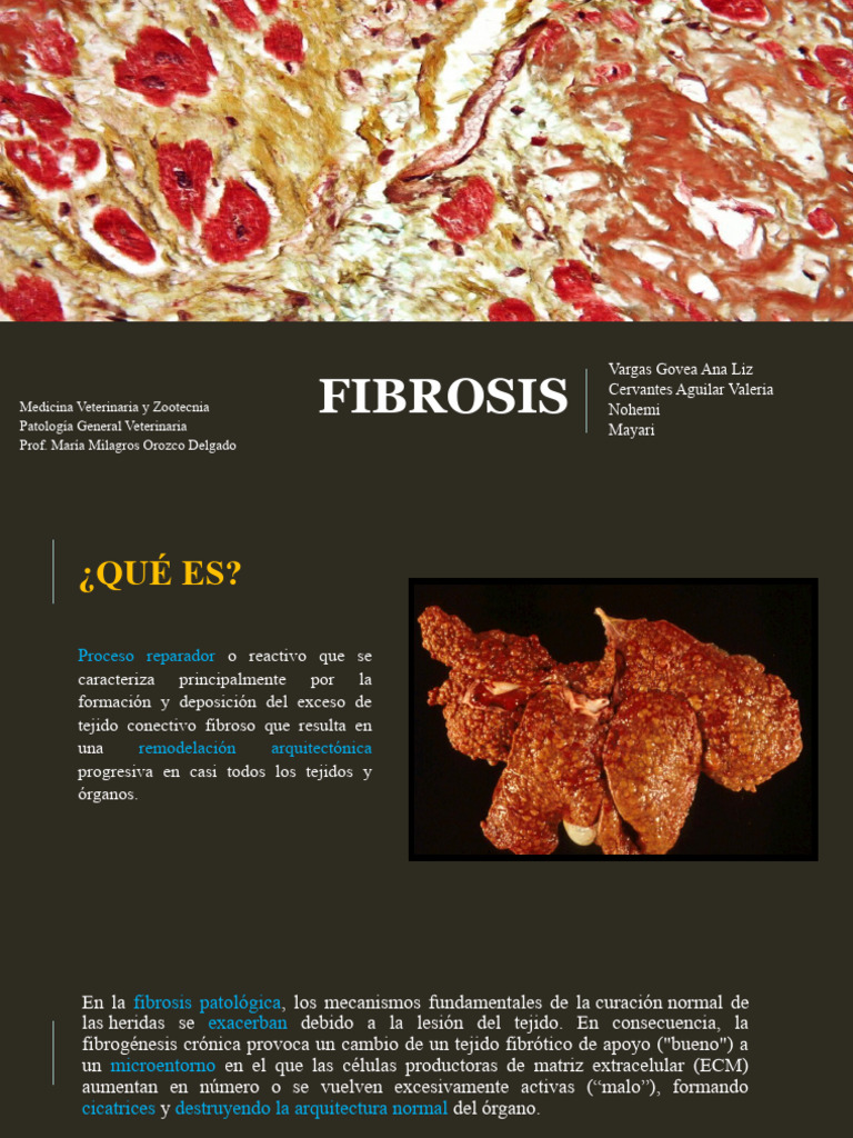Fibrosis | PDF