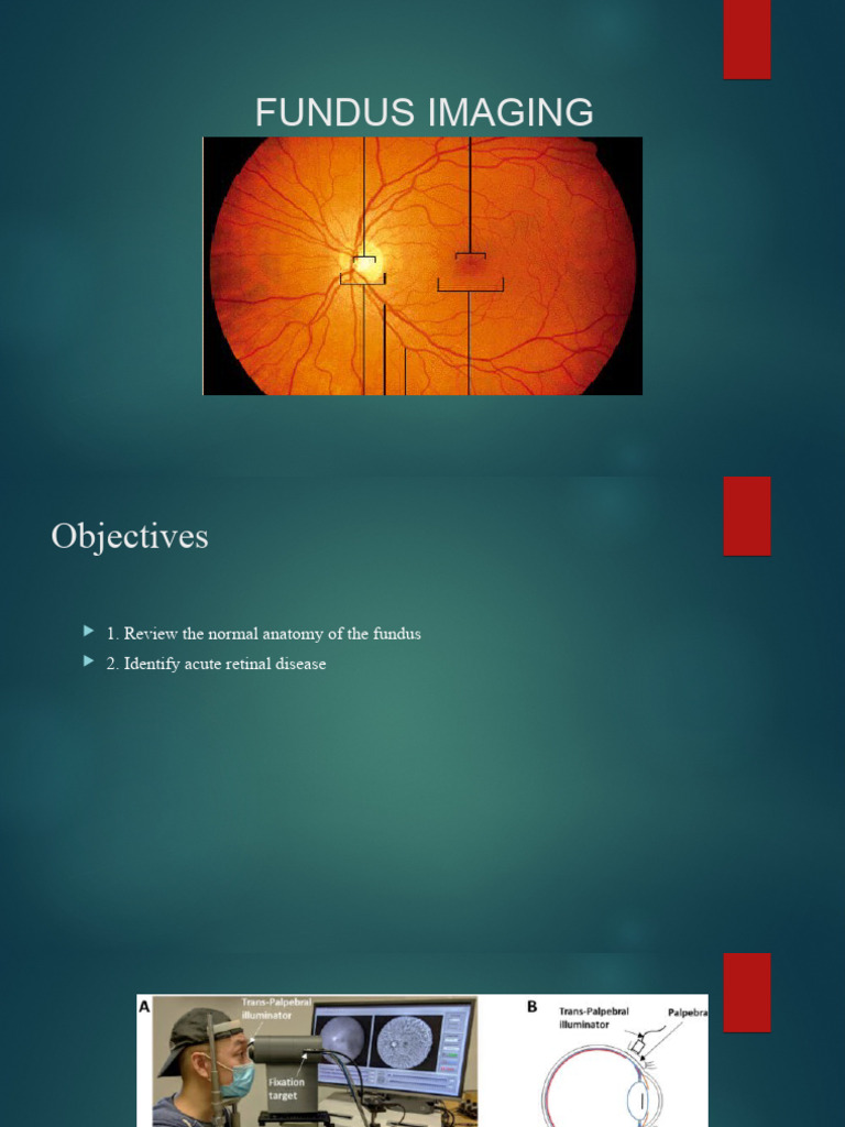 Fundus Photo | PDF | Retina | Blood Vessel