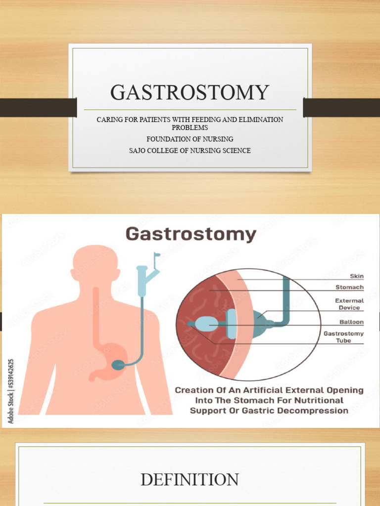 Gastrostomy Care Guide for Nurses | PDF | Medicine | Digestive System