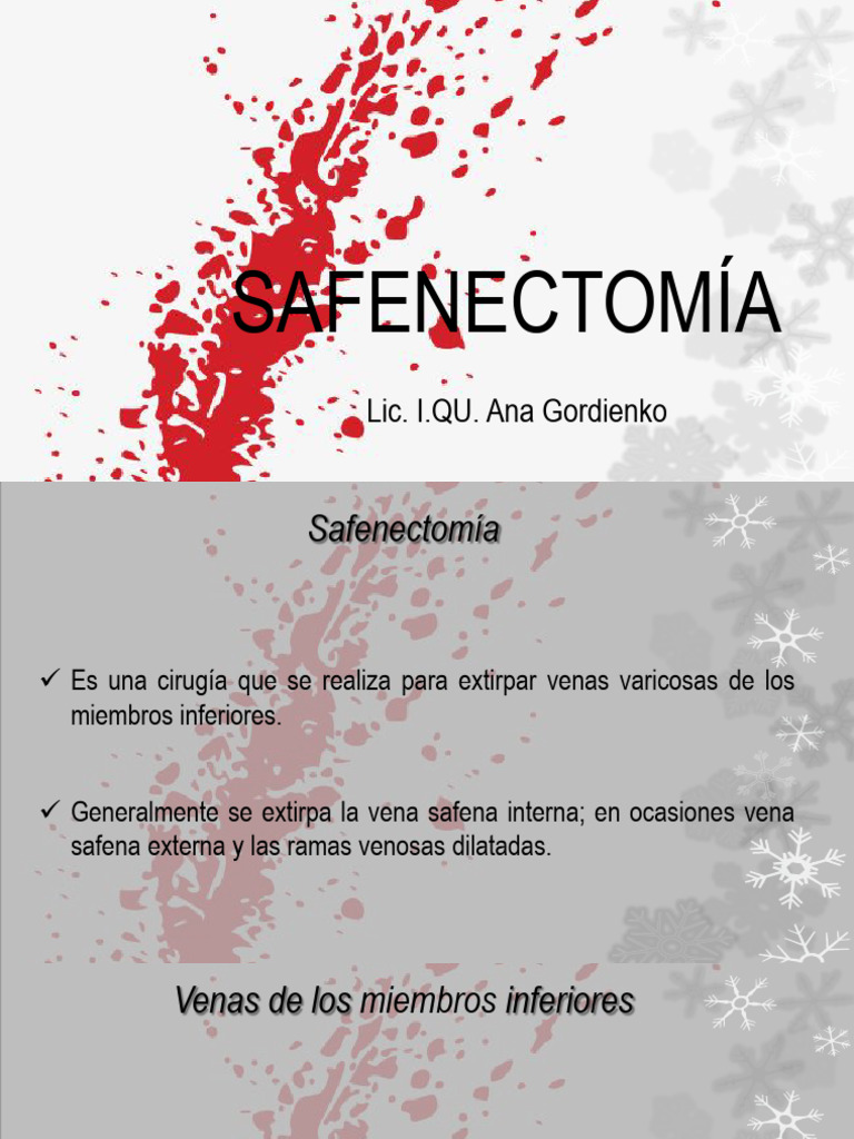 Safenectomía | PDF | Venas varicosas | Especialidades Medicas