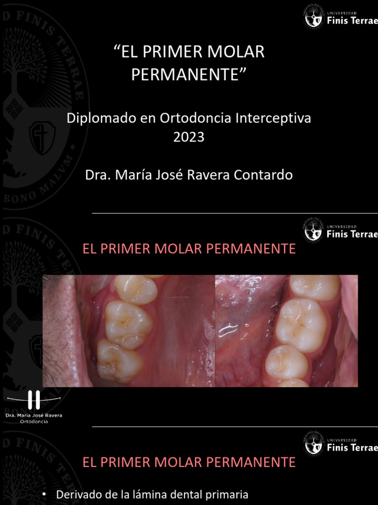 PRIMER-MOLAR | PDF | Odontología | Diente