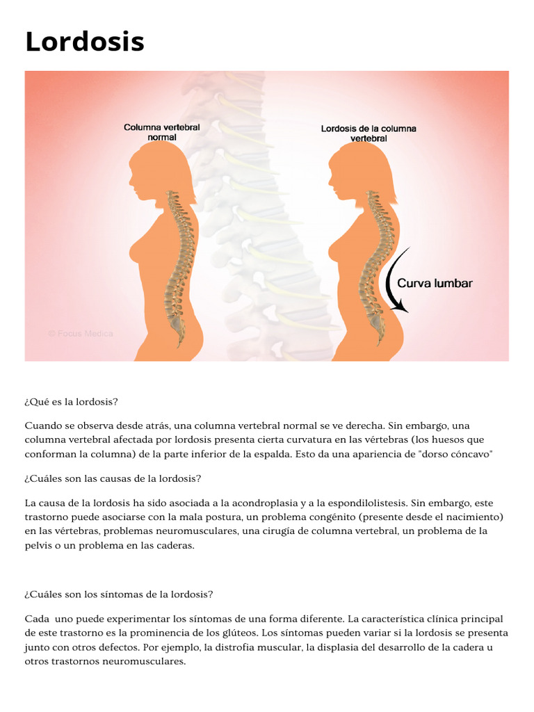 Lordosis 20240608 124856 0000 | PDF | Ct Scan | Imagen de resonancia magnética