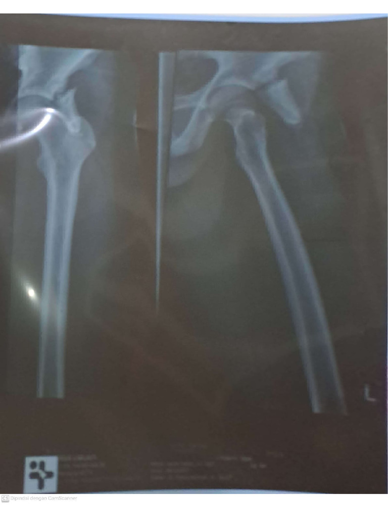 Hasil Rontgen 17 Mei 2024 Limijati | PDF