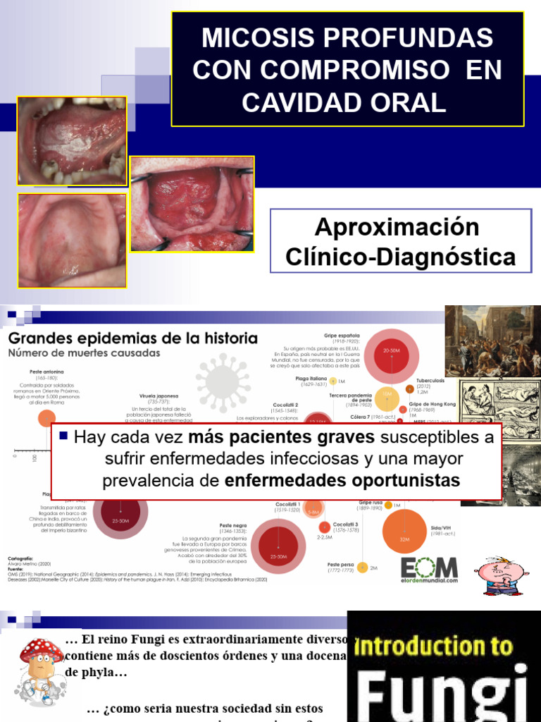 Micosis Profundas en Cavidad Oral - 2024 - 1 Final | PDF | Infección ...