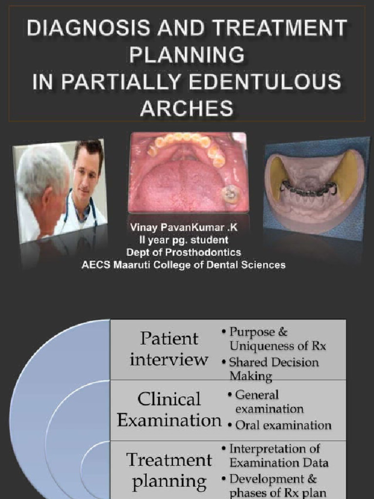 Diagnosis and Treatment Planning in RPD | PDF