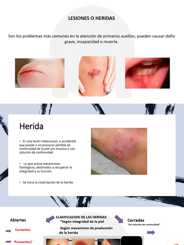 10 Heridas Simples y Complejas | PDF | Herida | Curación