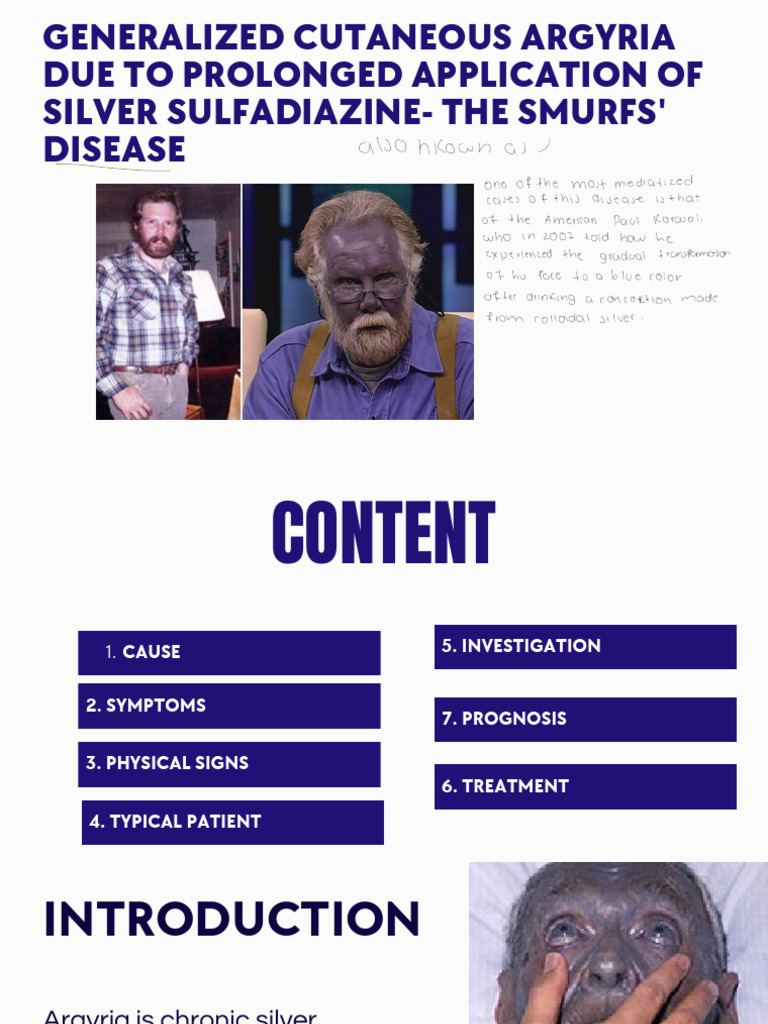 Generalized Cutaneous Argyria Due To Prolonged Application of Silver ...