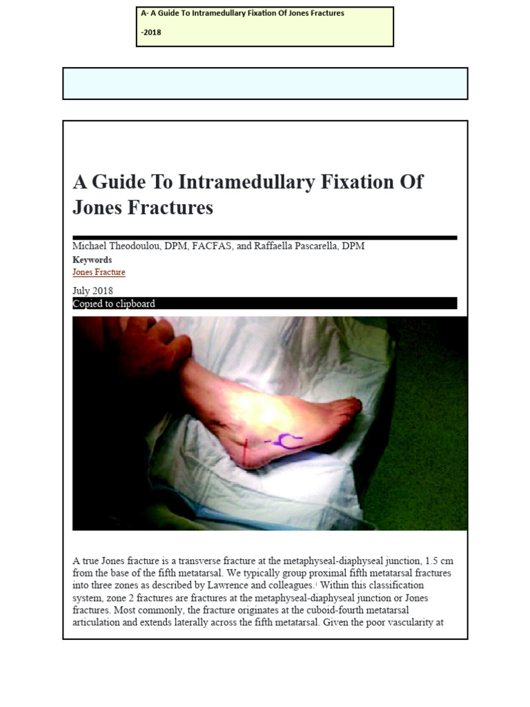 A - A Guide To Intramedullary Fixation of Jones Fractures | PDF ...
