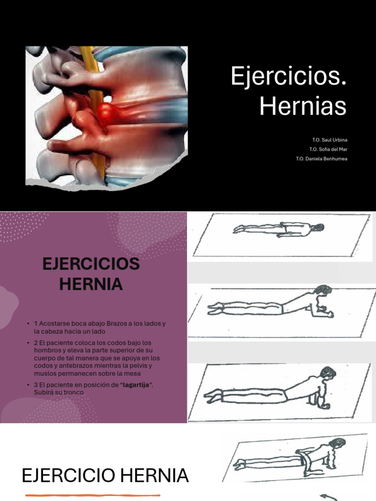 Hernia y Escolesosis | PDF | Hombro | Rodilla