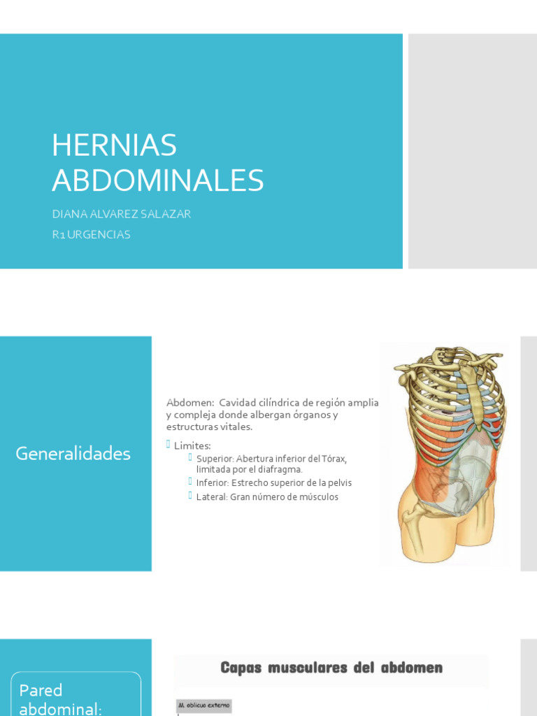 Guía Completa sobre Hernias Abdominales | PDF | Abdomen | Anatomía