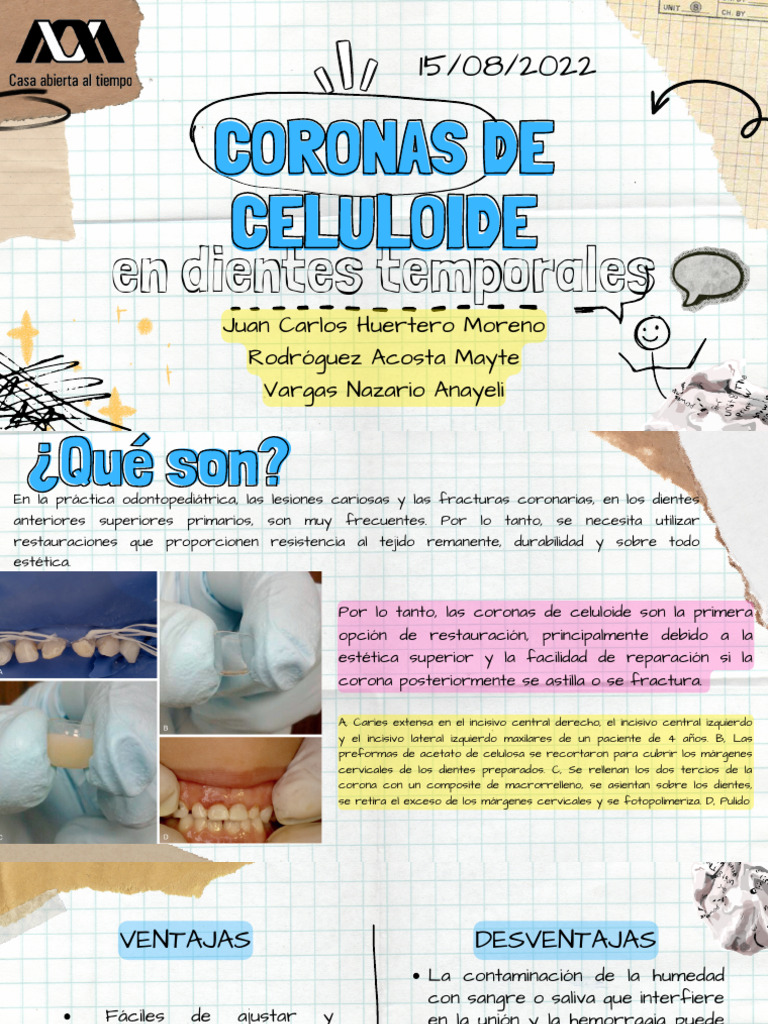 Coronas de Celuloide en Odontopediatría | PDF | Odontología | Esmalte ...