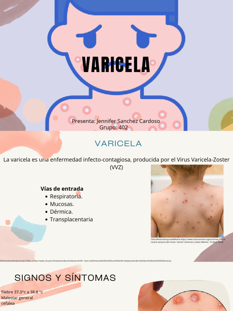 Varicela | PDF | Virología | Epidemiología