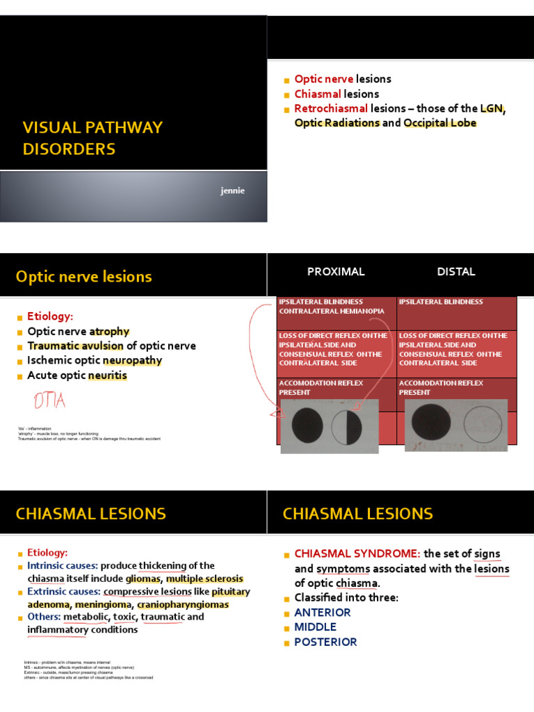 Visual Pathway Disorders.pptx | PDF | Human Eye | Ophthalmology