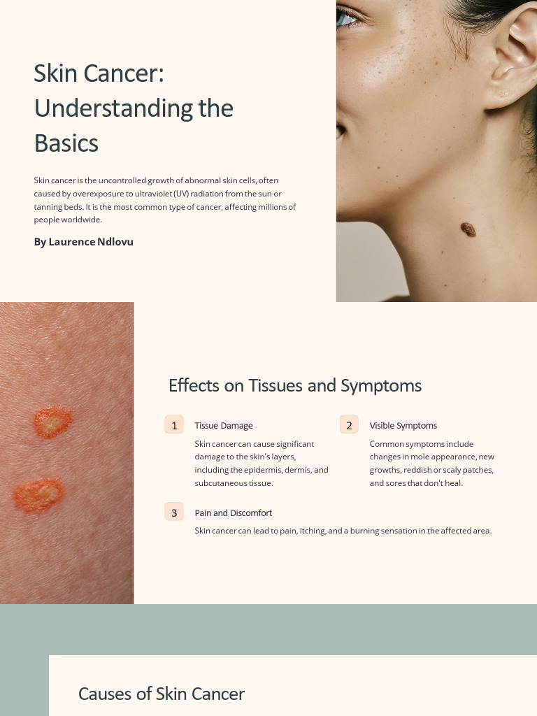 Skin-Cancer-Understanding-the-Basics - by Laurence Ndlovu | PDF | Skin ...