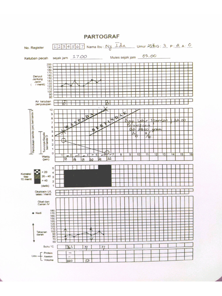Partograf | PDF