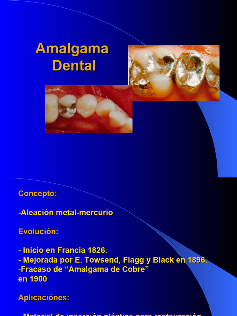 Amalgama Dental | PDF | Mercurio (Elemento) | Cobre