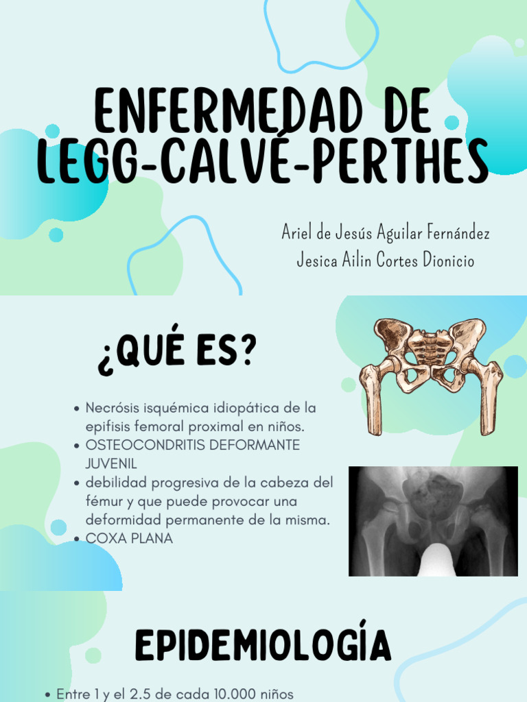Enfermedad De Legg-Calvé-Perthes. Revisión Actualizada – RYWXSV