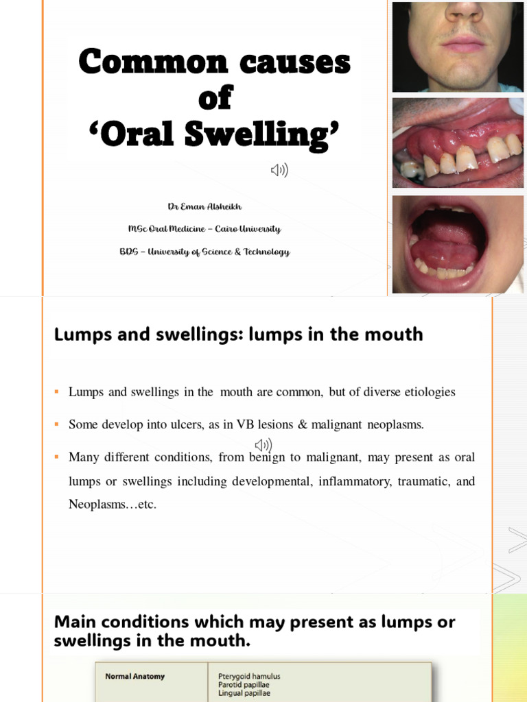 Oral Swelling | PDF | Diseases And Disorders | Medical Specialties