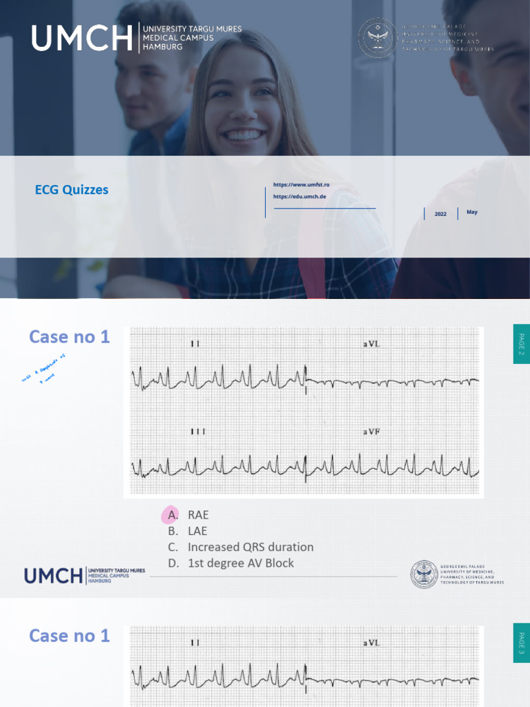 PA 8 - ECG Quiz | PDF | Internal Medicine | Cardiovascular Physiology