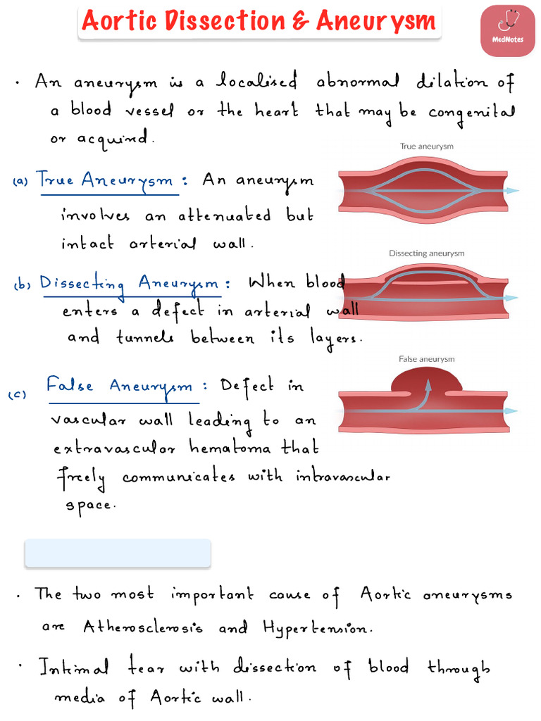 Aortic Dissection - Aneurysm | PDF | Aorta | Angiology