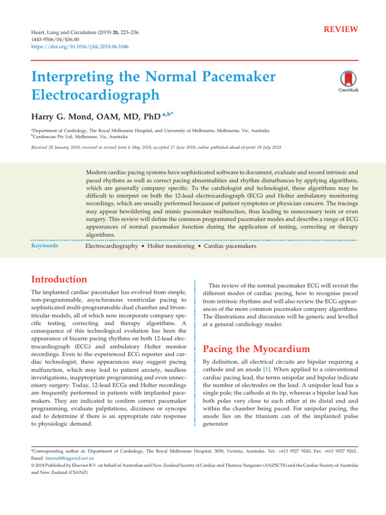 Interpreting The Normal Pacemaker Electrocardiograph HLC 2019 | PDF ...