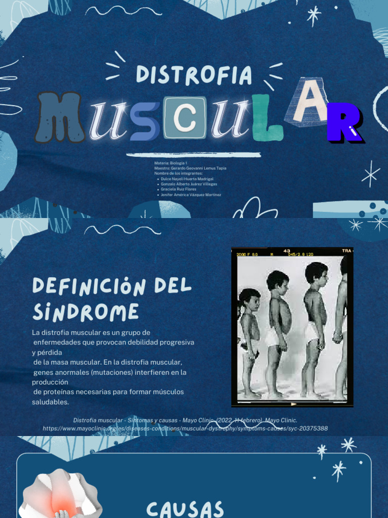 Hipotonía y Distrofia Muscular Infantil | PDF | Distrofia muscular ...
